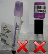 Proper Tube Labeling